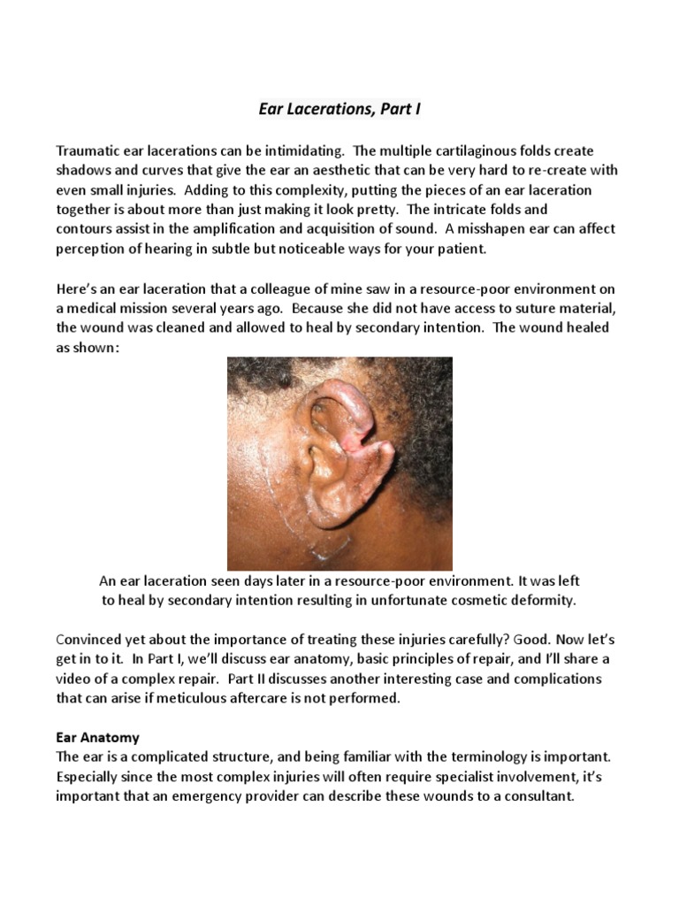 Ear Lacerations | PDF | Ear | Wound