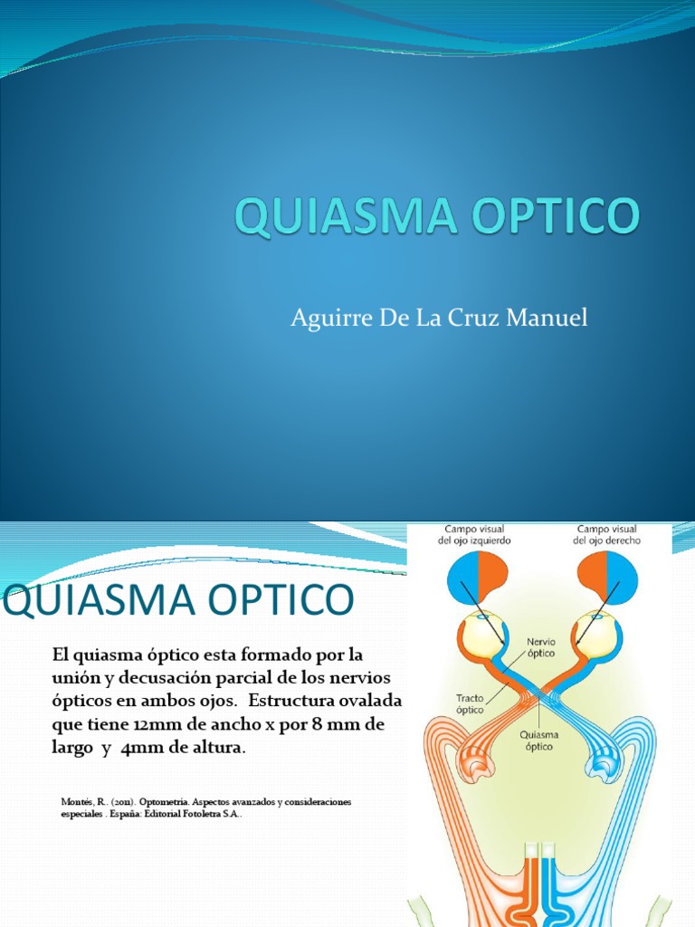 Quiasma Optico | PDF | Percepción visual | Ojo