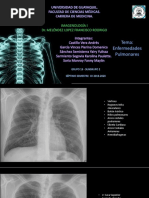 INTERPRETACION DE RX TORAX AP, PA Y LATERAL | PDF | Pulmón | Tórax ...