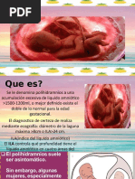 Manejo Anhidramnios DR Douglas Needham Torres - Archivo | PDF | Riñón ...