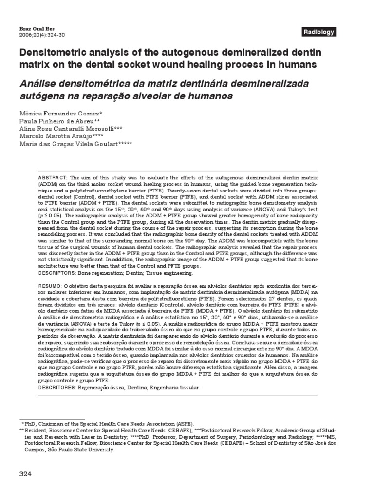 Densitometric Analysis of The Autogenous Demineralized Dentin Matrix On ...