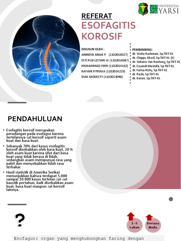 Esofagitis Korosif | PDF