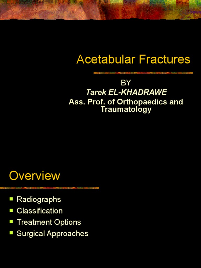 Acetabular Fracture Postgraduate | PDF | Anatomical Terms Of Location | Hip