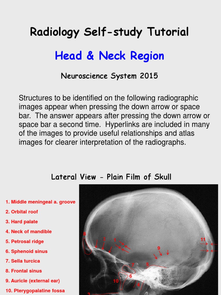 Head&Neck Radiology Tutorial 2015 | PDF | Common Carotid Artery | Skull