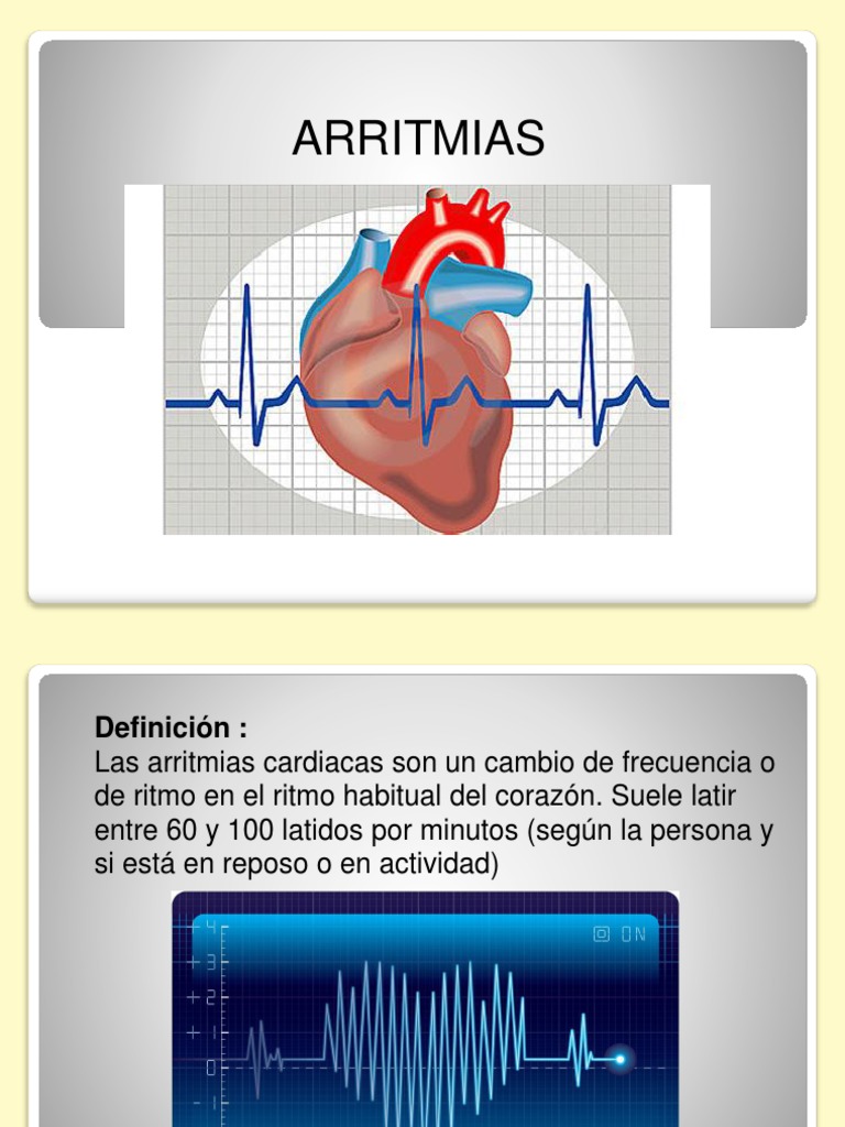 arritmias.pptx | Fisiología Cardiovascular | Fisiología