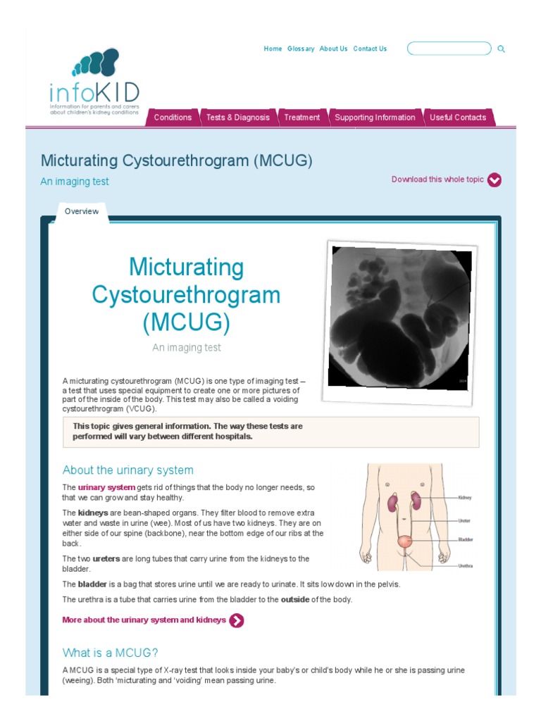 Micturating Cystourethrogram (MCUG) - infoKID PDF | PDF | Urinary Tract ...