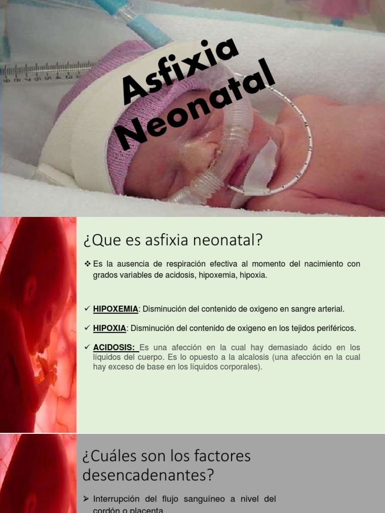 Asfixia Neonatal | PDF | Inflamación | Parto