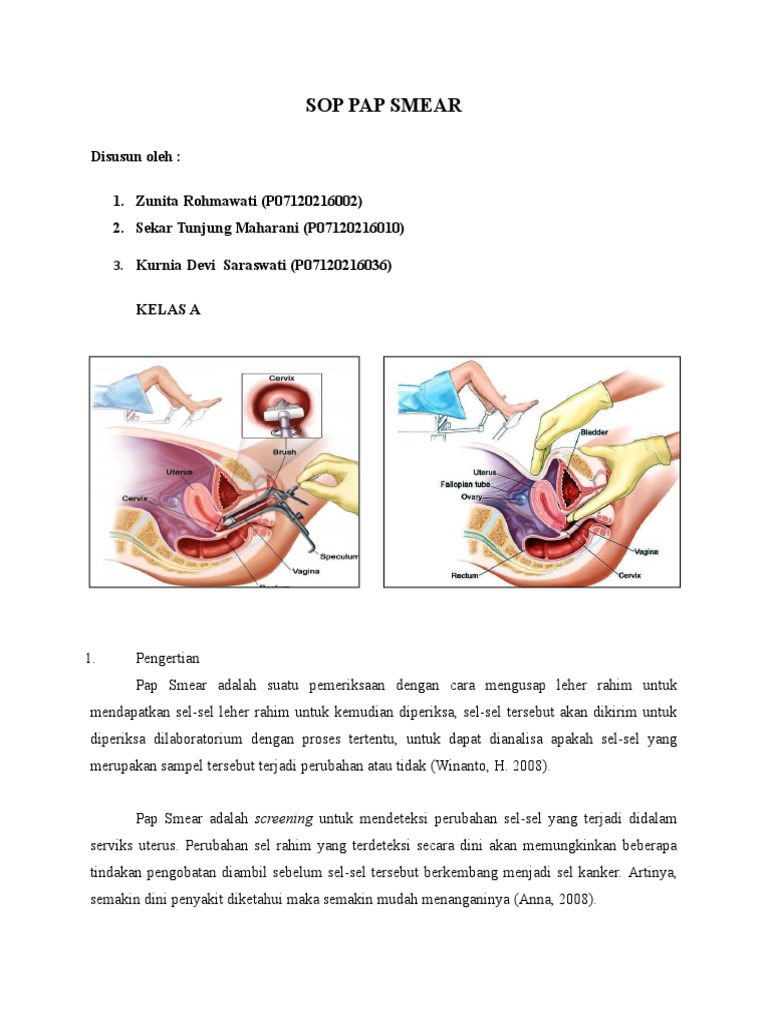 Sop Pemeriksaan Pap Smear Pdf Kajian Bahasa Asing Kesehatan Holistik 