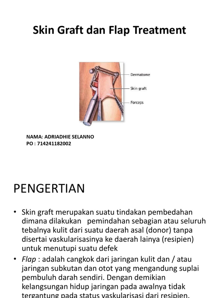 Perbandingan Skin Graft dan Flap | PDF | Sains & Matematika | Teknologi ...