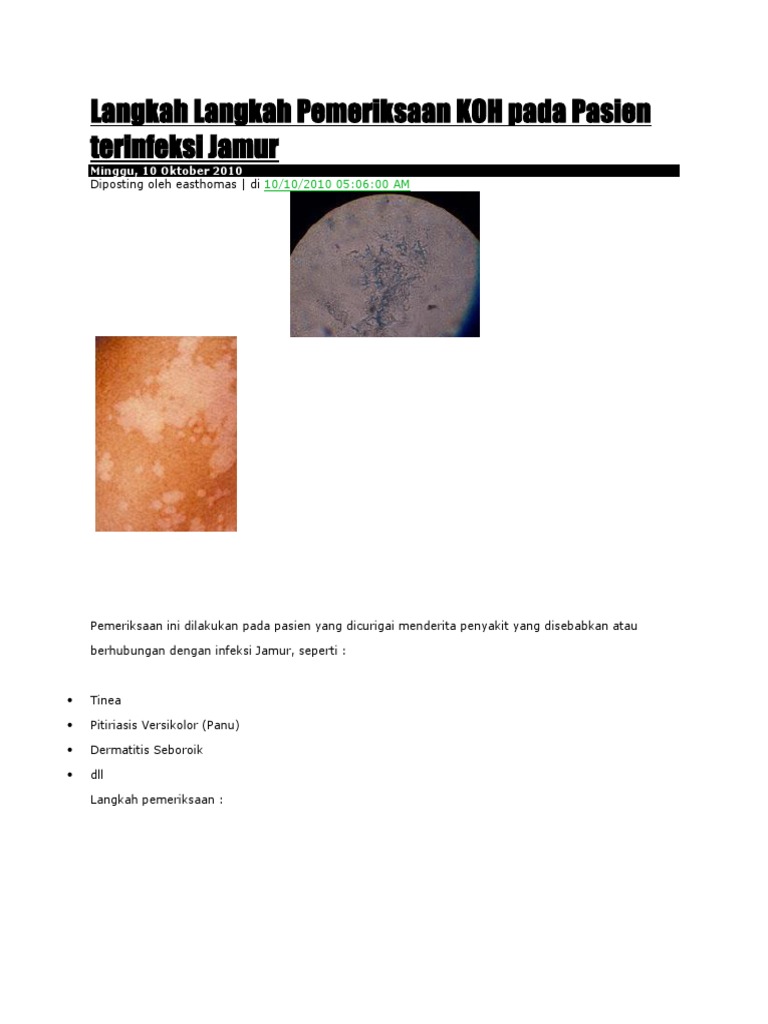 Langkah Langkah Pemeriksaan KOH Pada Pasien Terinfeksi Jamur | PDF