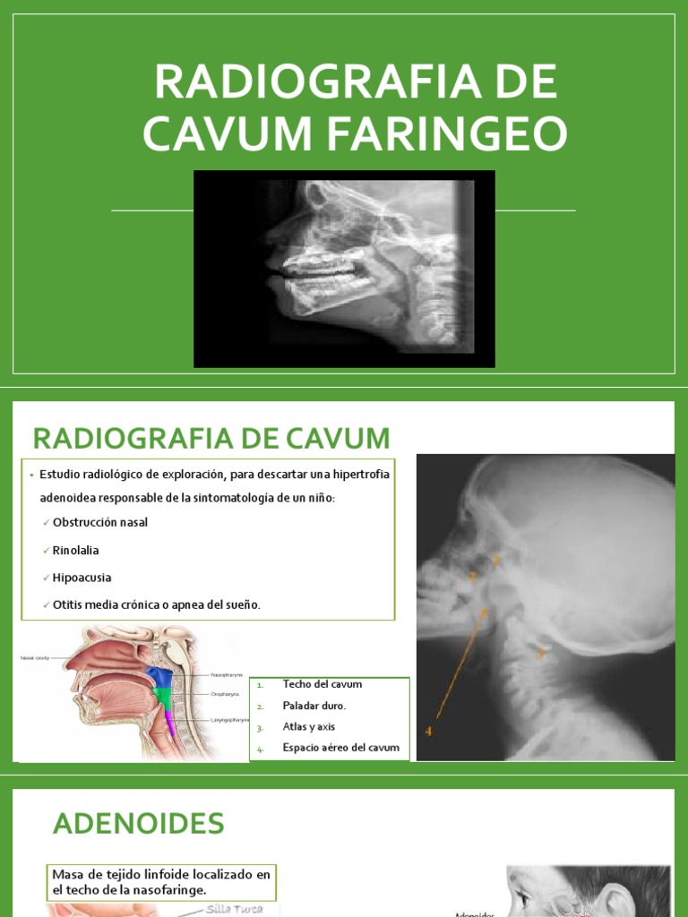 Radiografia de Cavum y Atm | PDF | Articulación | Sistema ...