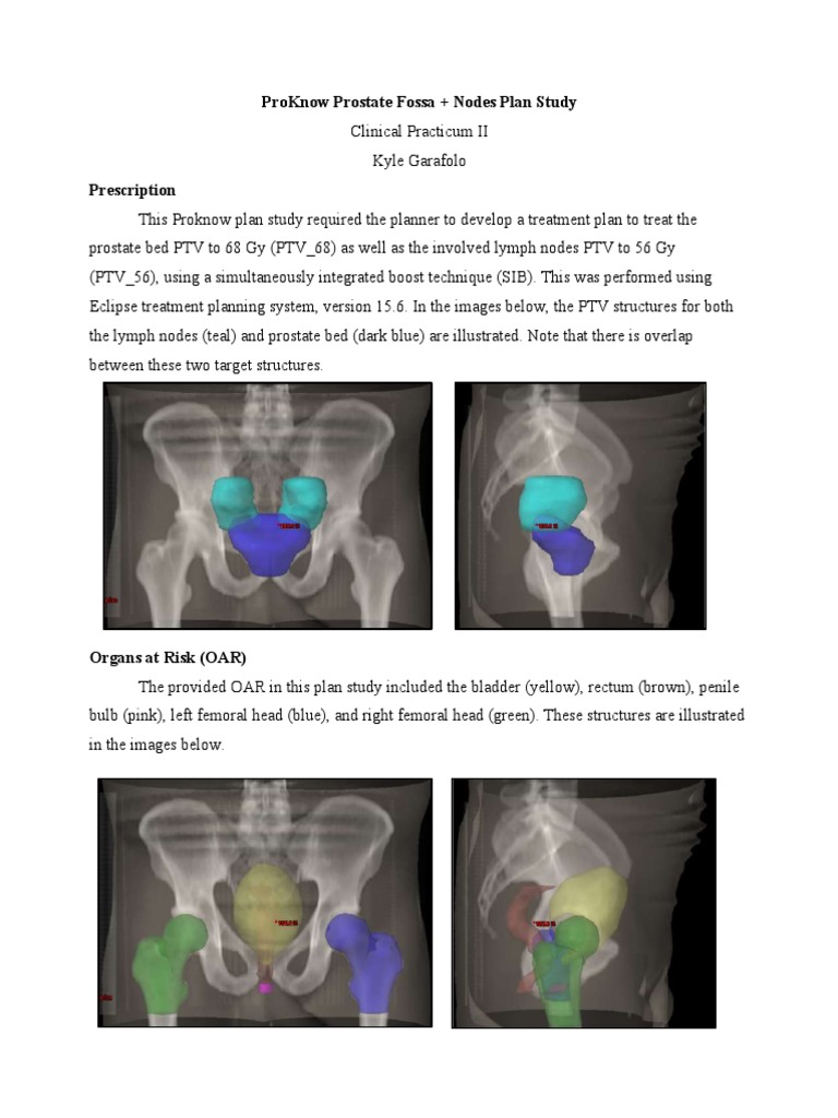 Proknow Prostate Fossa Final PDF Compressed | PDF | Mathematical ...