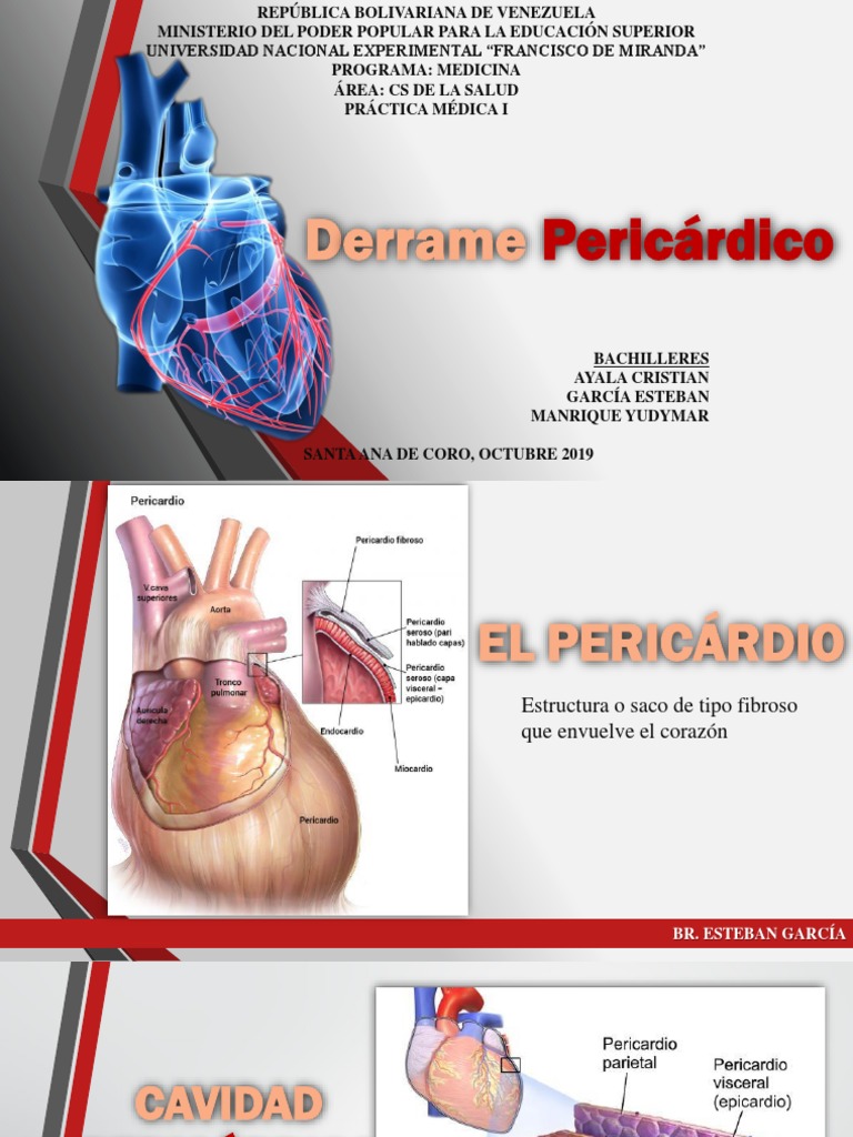 Derrame Pericardico. | PDF | Medicina | Medicina CLINICA