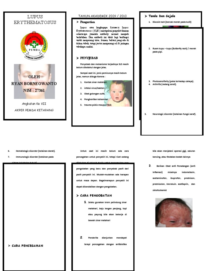 Leaflet Lupus | PDF | Sains & Matematika