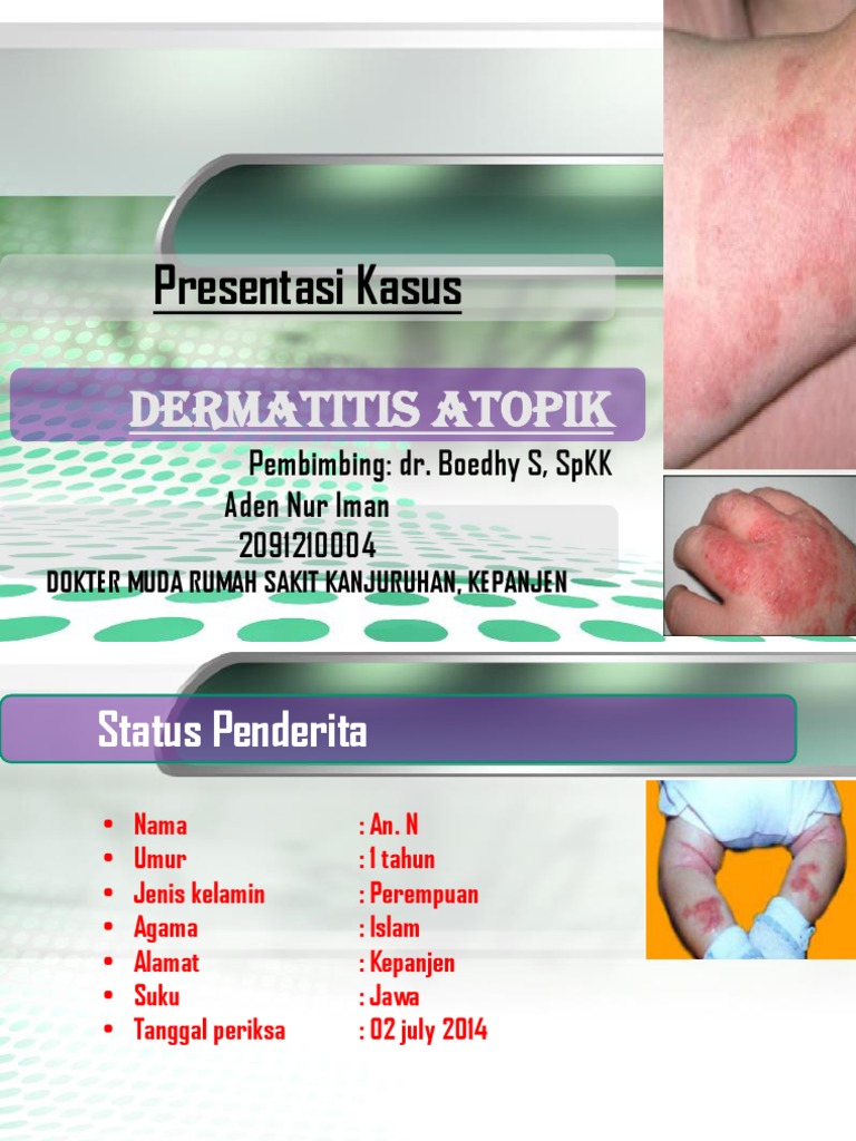 Dermatitis Atopik pada Bayi: Kasus An. N | PDF