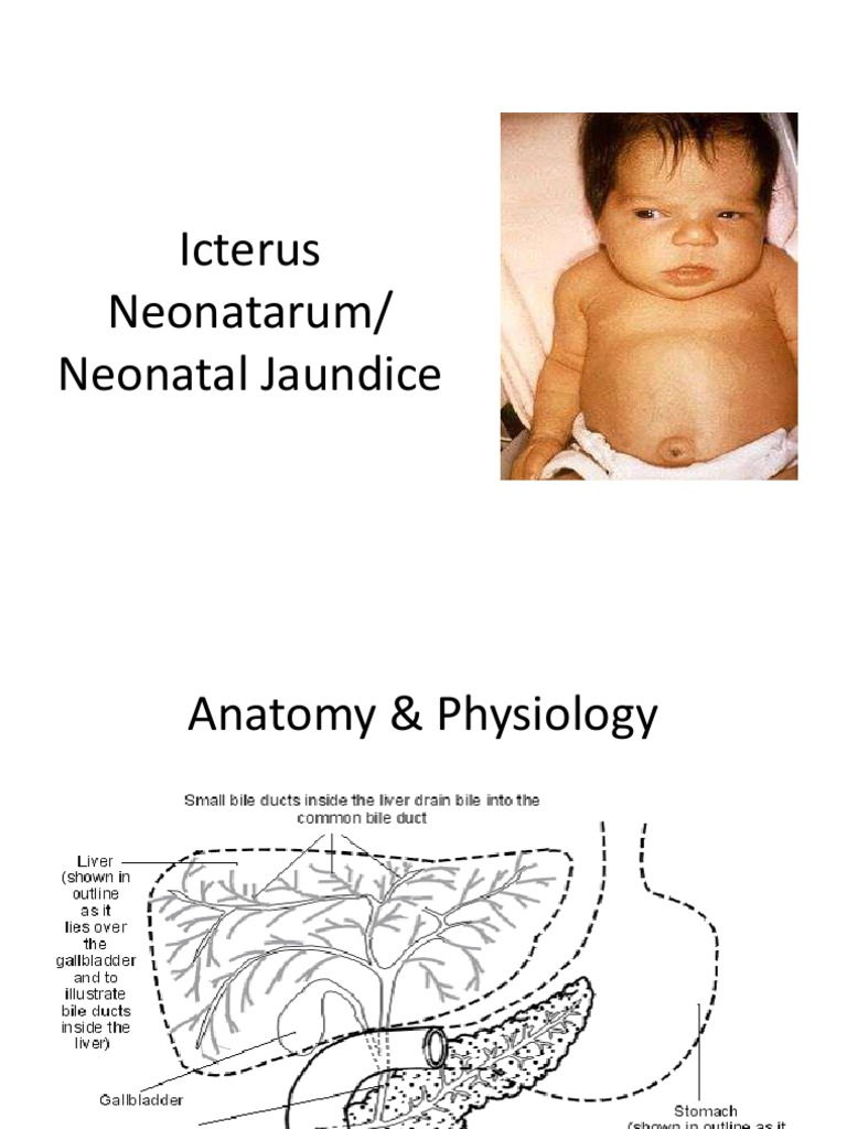 Icterus Neonatarum | PDF | Health Sciences | Medicine