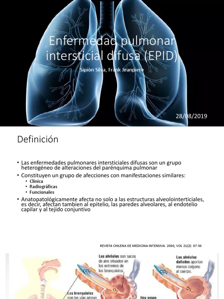 Enfermedad Pulmonar Intersticial Difusa (EPID) .PPTX Versión 1 | PDF | Inflamación | Nicotina