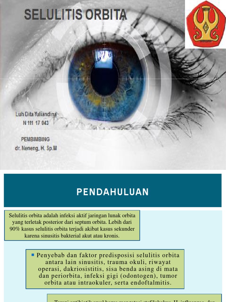 Selulitis Orbita | PDF