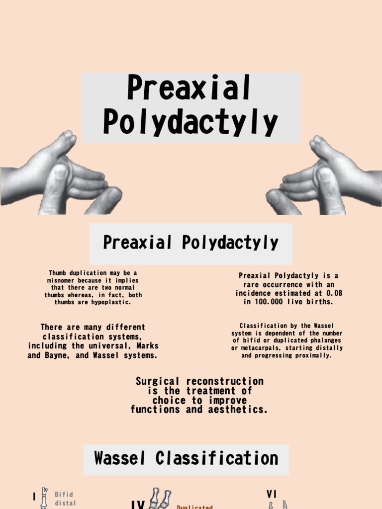 Preaxial Polydactyly | PDF | Thumb | Hand