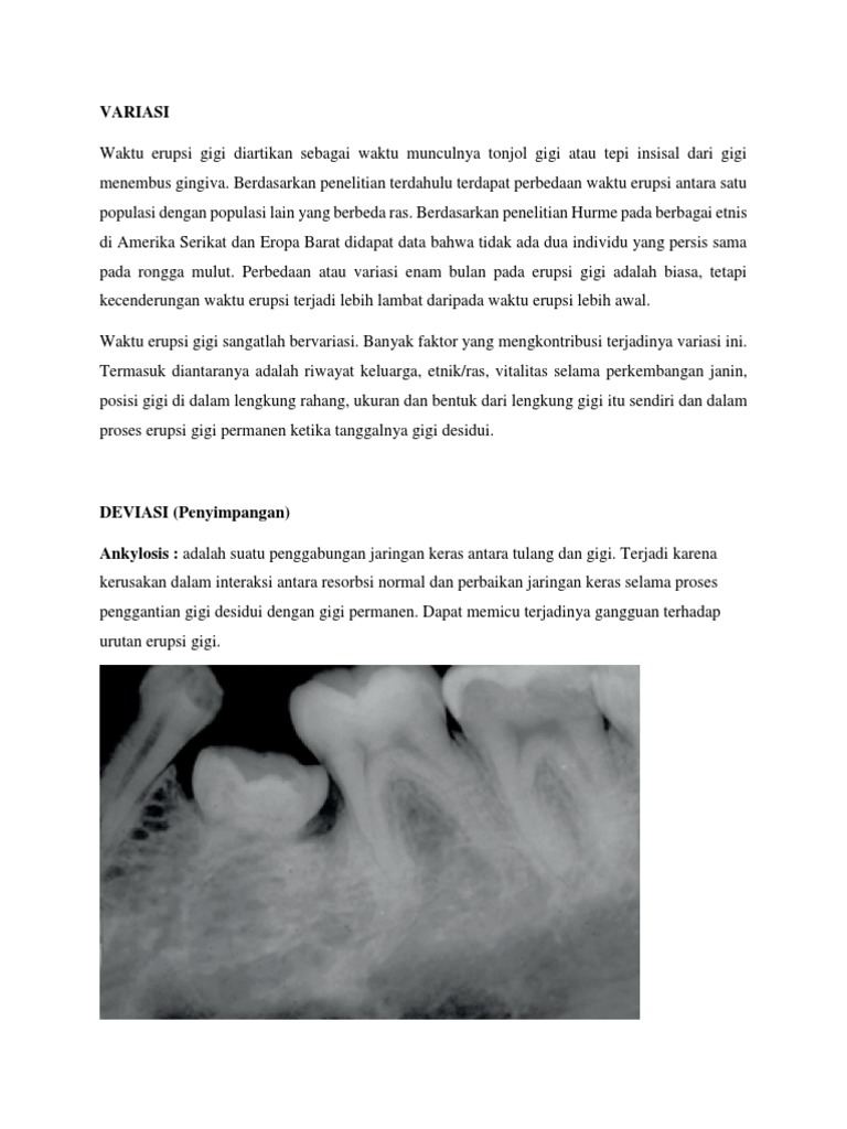 Variasi Dan Deviasi Erupsi Gigi | PDF