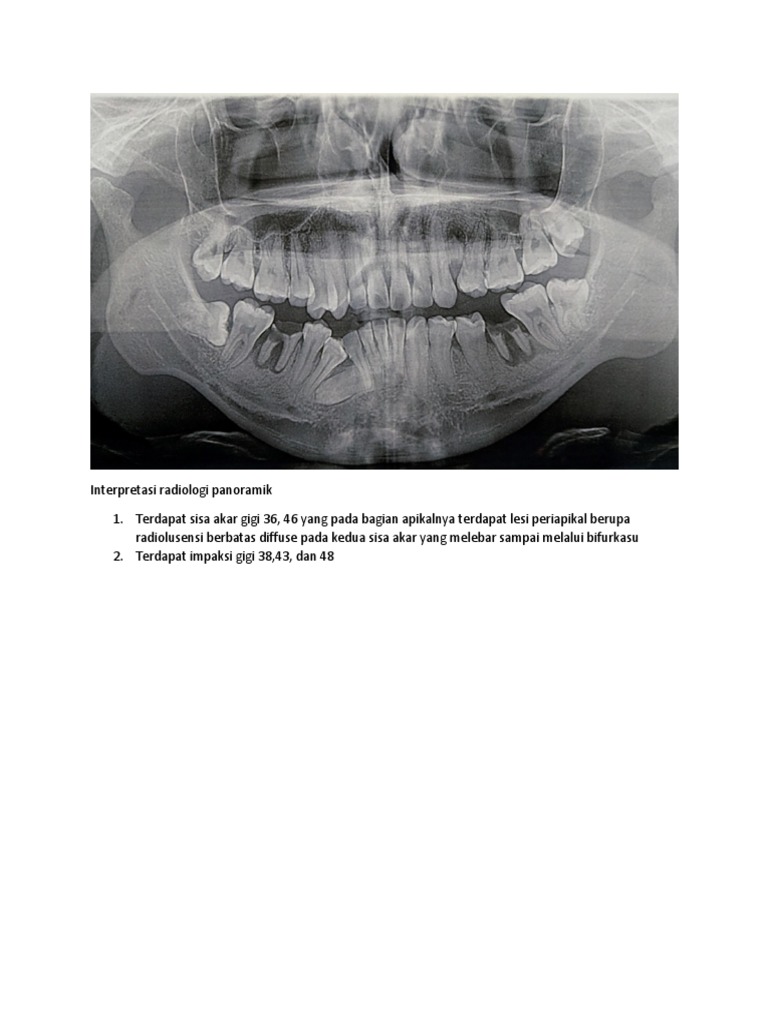 Interpretasi Radiologi Panoramik GTJ | PDF