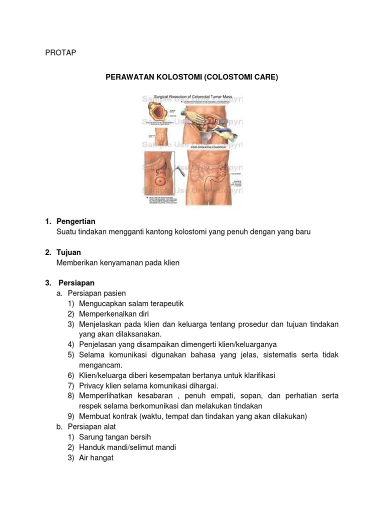 PROTAP Colostomi | PDF