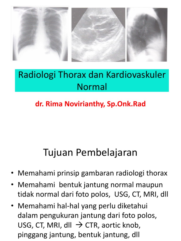 Radiologi Kardiovaskuler Normal | PDF