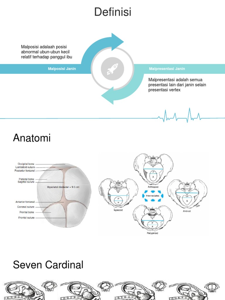 Malposisi Janin | PDF