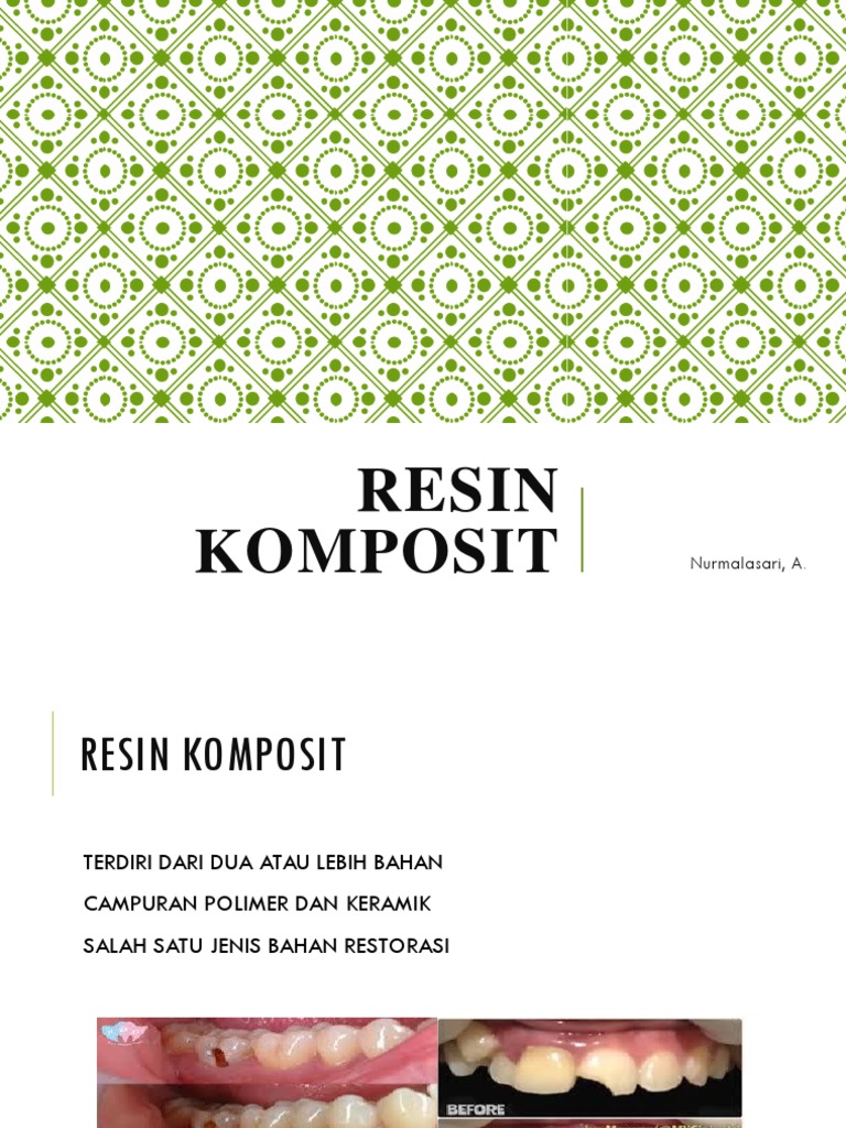 Resin Komposit 2019 | PDF