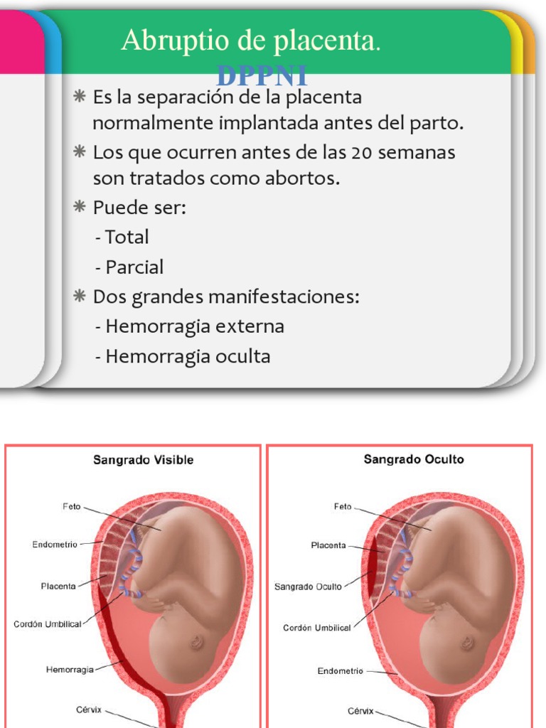 Ruptura Del Seno Marginal