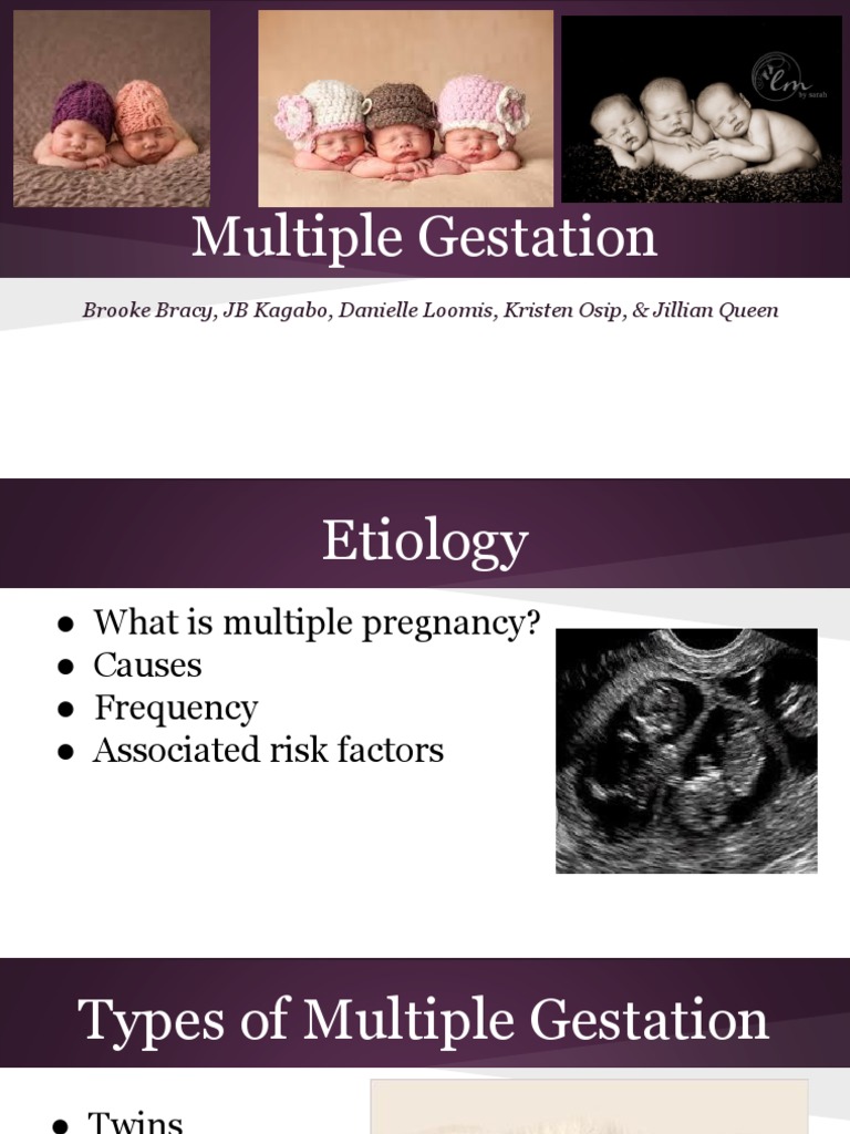 Multiple Gestation PPT | PDF | Multiple Births | Twin