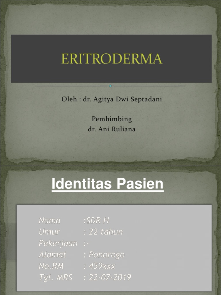 Eritroderma-Ppt Presentasi | PDF