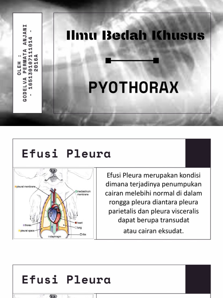 Pyothorax | PDF