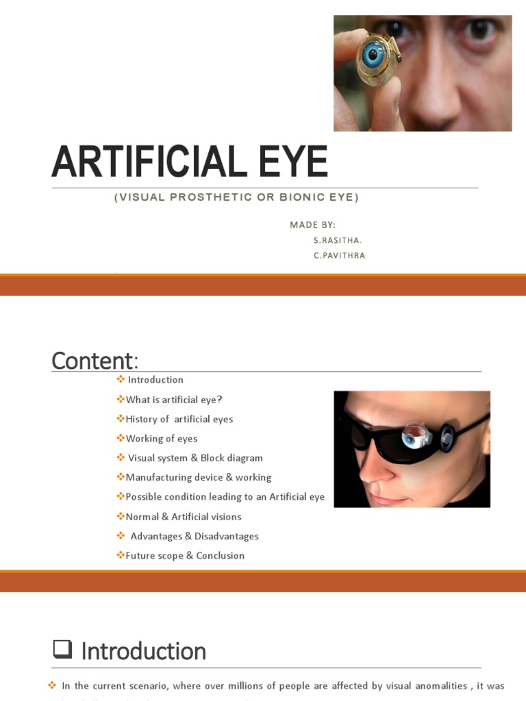 Artificial Eyes | PDF | Visual System | Retina