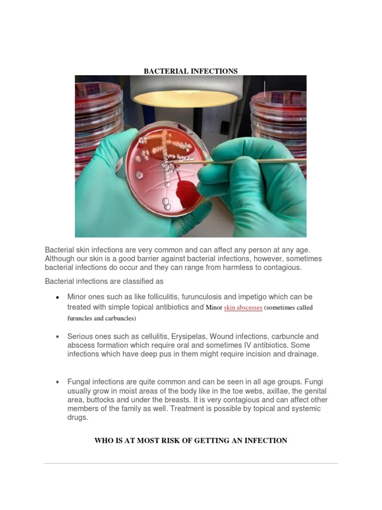 Bacterial Infections - What Are Bacterial Infections - Treatment and ...