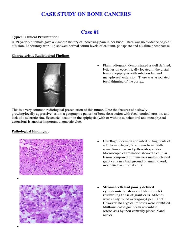 Case Study On Bone Cancers | PDF | Metastasis | Bone
