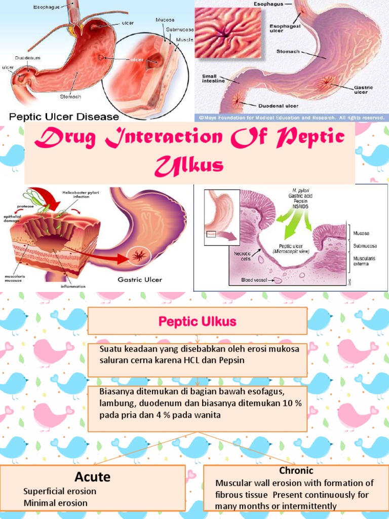 Drug Interaction of Peptic Ulkus | PDF