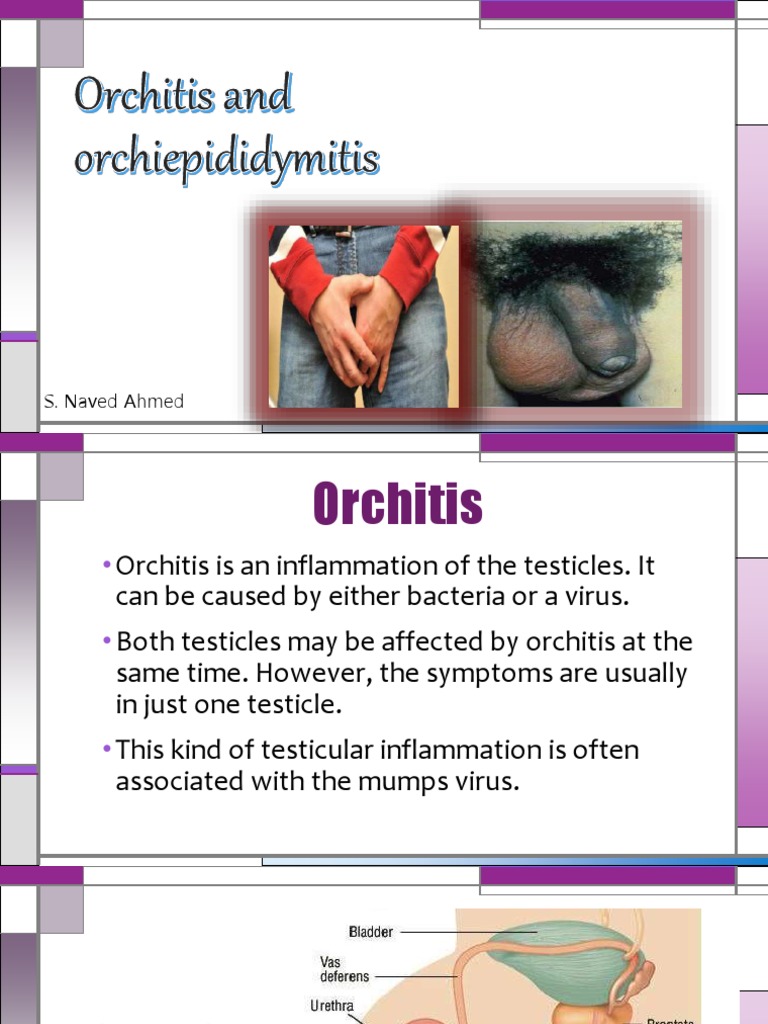 Testicular Inflammation: Causes, Symptoms and Treatment of Orchitis and ...