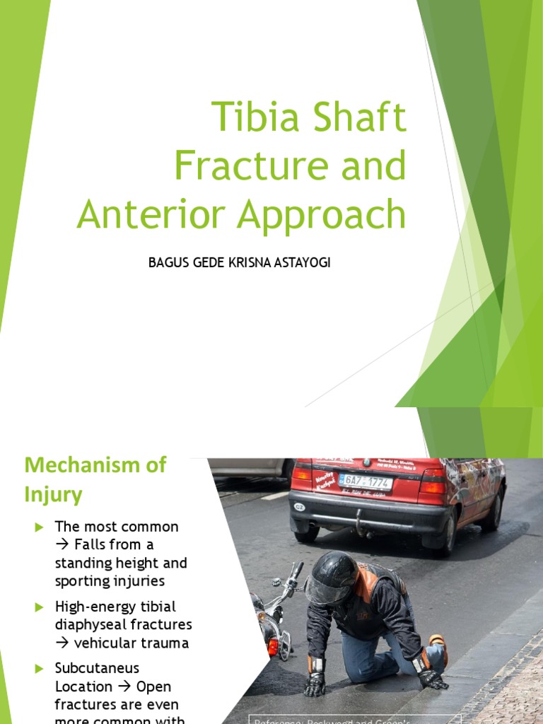 Tibial Shaft Fracture | PDF | Ankle | Knee