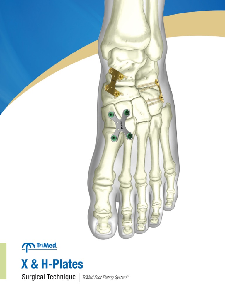 X & H Plate PDF | PDF | Surgery | Screw