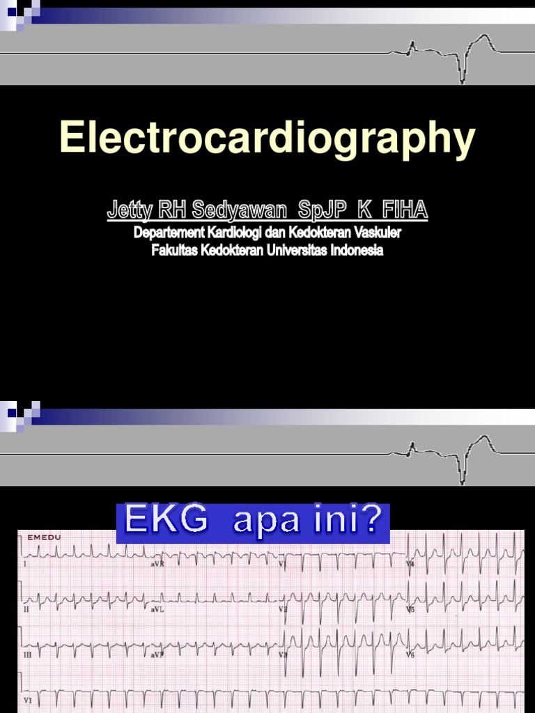 EKG FOR THE BEGINNERS | Electrocardiography | Physiology