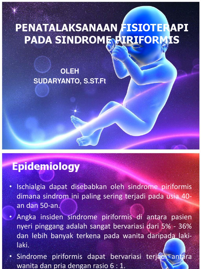 Fisioterapi Pada Sindrome Piriformis | PDF