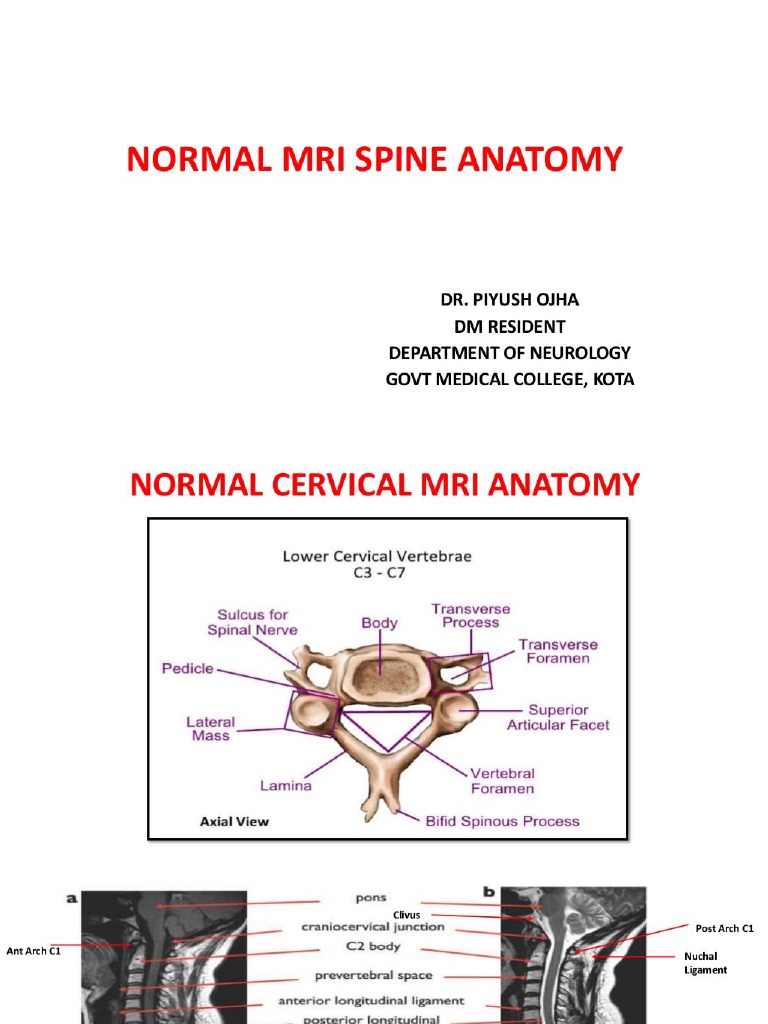 Mri Spine Anatomy | PDF