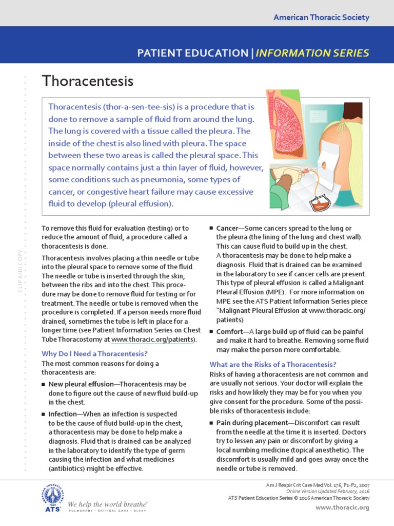 Thoracentesis PDF | PDF | Medical Specialties | Clinical Medicine