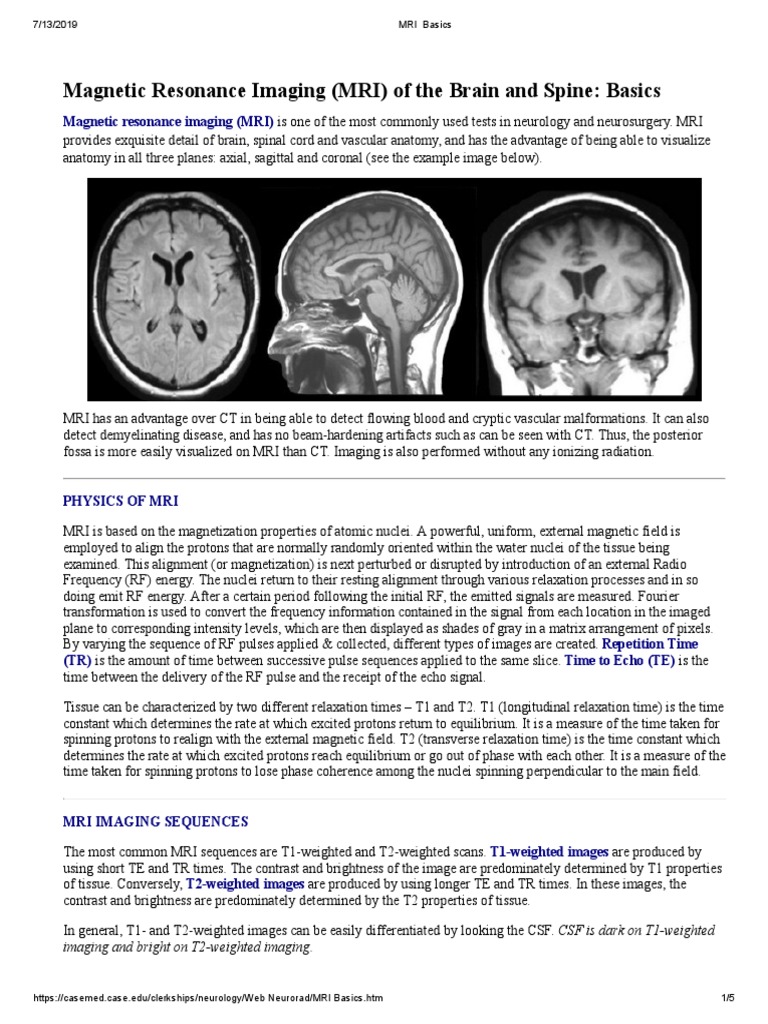 MRI Basic | Download Free PDF | Magnetic Resonance Imaging | Relaxation ...