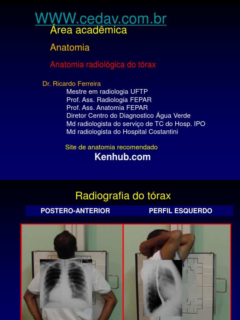 Anatomia Radiológica do Tórax | PDF | Pulmão | Anatomia
