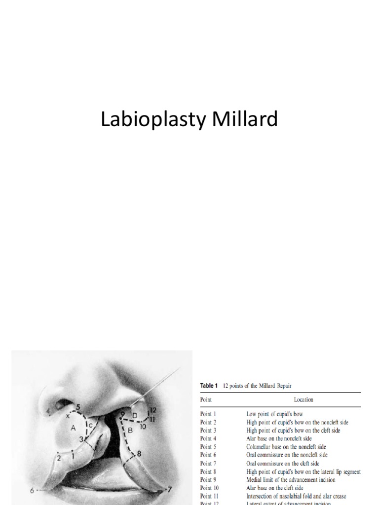 Labioplasty Millard | PDF