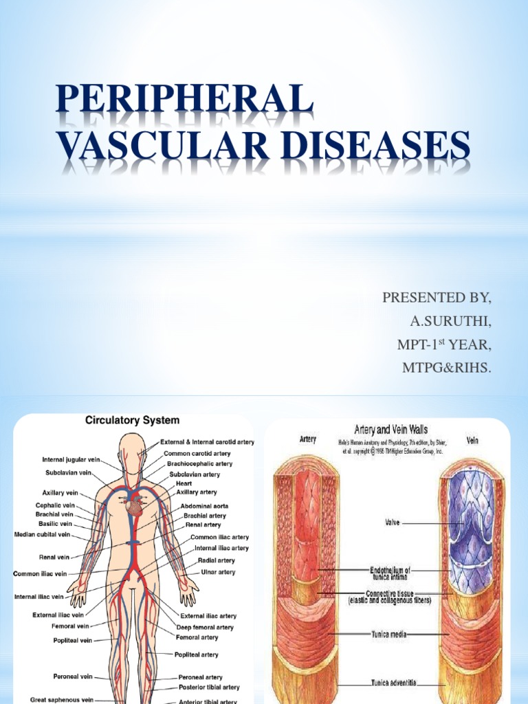 Overview of Peripheral Vascular Diseases | PDF | Ischemia | Circulatory ...