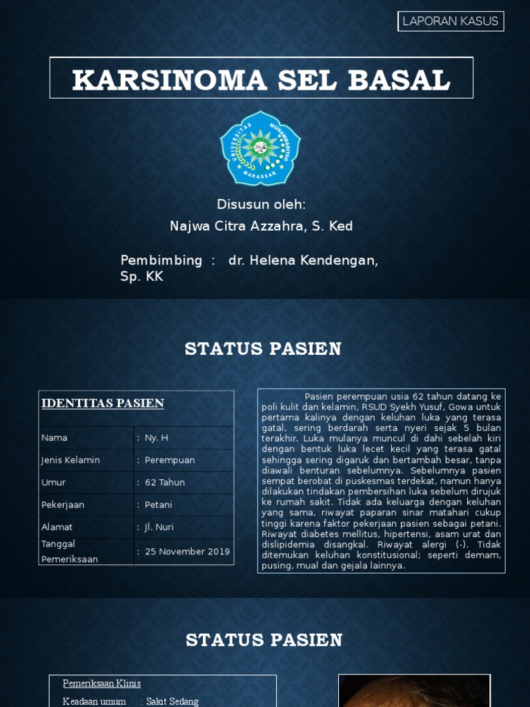 Laporan Kasus - Basalioma | PDF