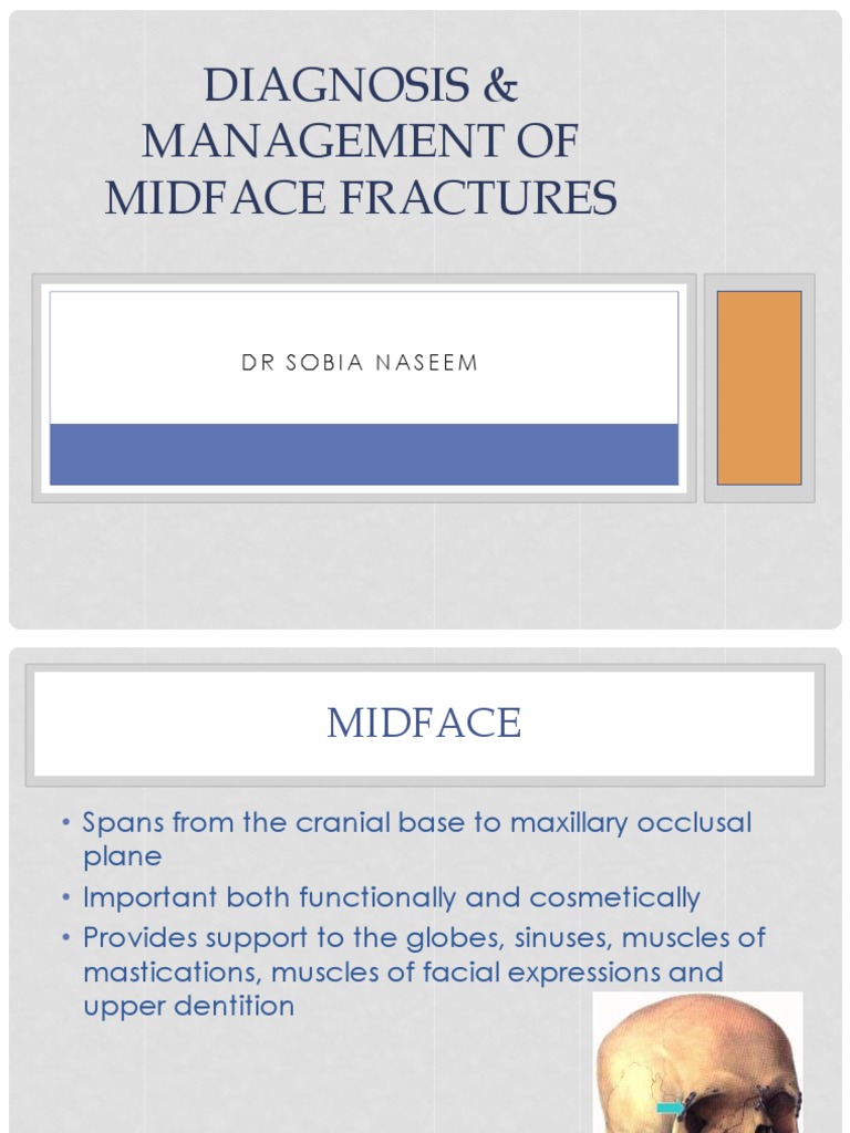 Diagnosis & Management of Midface Fractures | PDF | Human Nose | Face